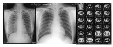 Xray Films factory, Buy good quality Xray Films products from China