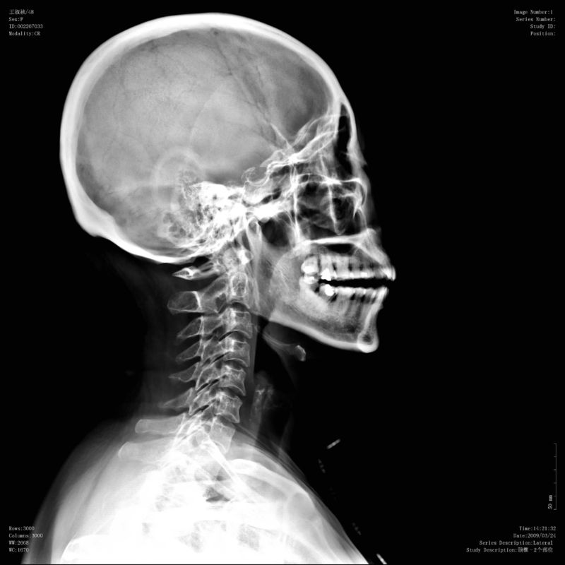 Konida High Density Medical Digital Xray Transparency Film KND-F For ...