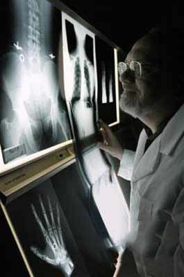 Diagnostic Laser X Ray Dry Film Medical For AGFA / Fuji Printer