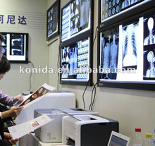 Medical X Ray Thermal Printer Film KND-F25*30cm