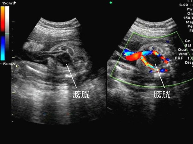 3D / 4D Full Digital Color Doppler Ultrasound System With Broadband Probes