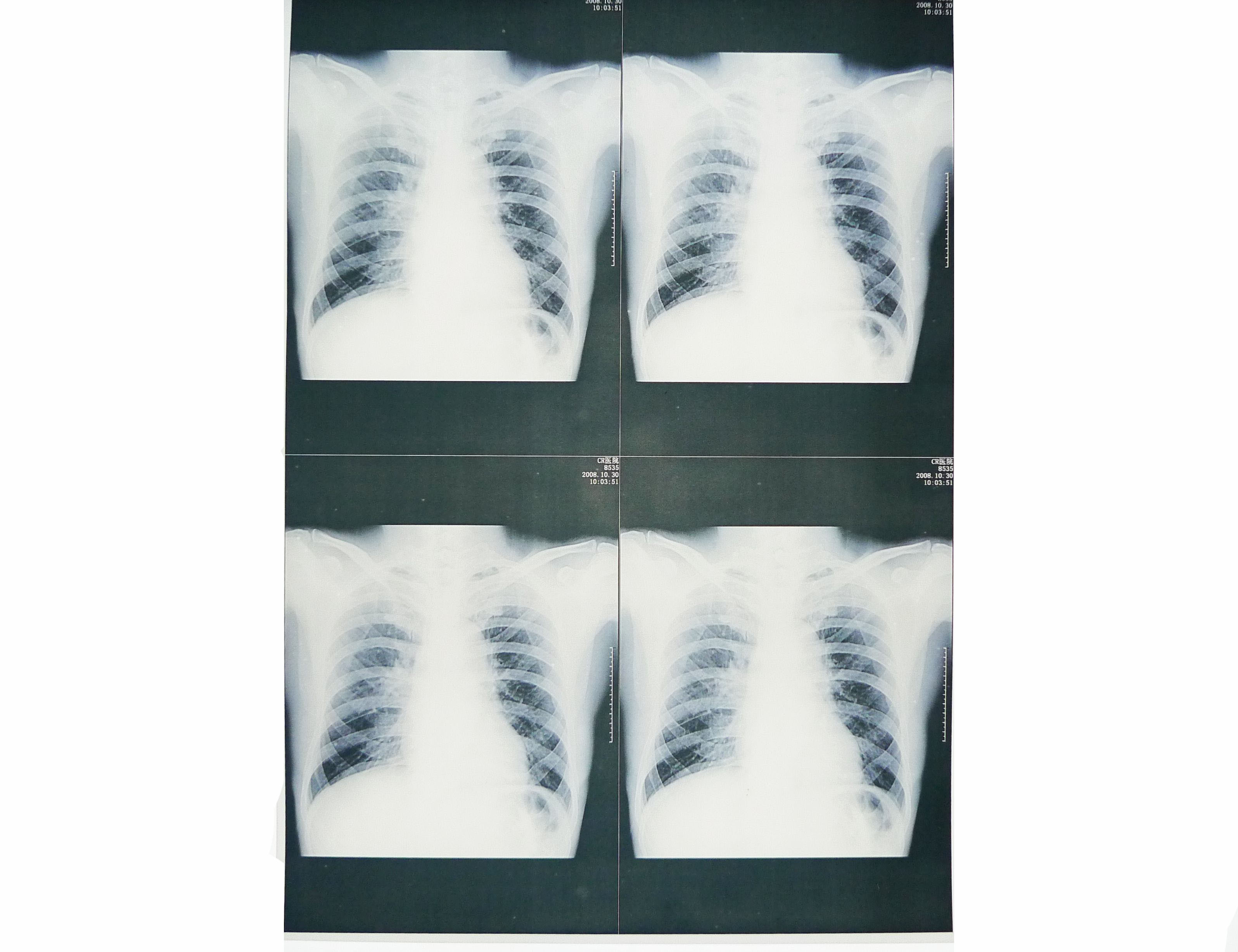 White Base Medical X Ray Paper Film Moistureproof For Sony / EPSON ...