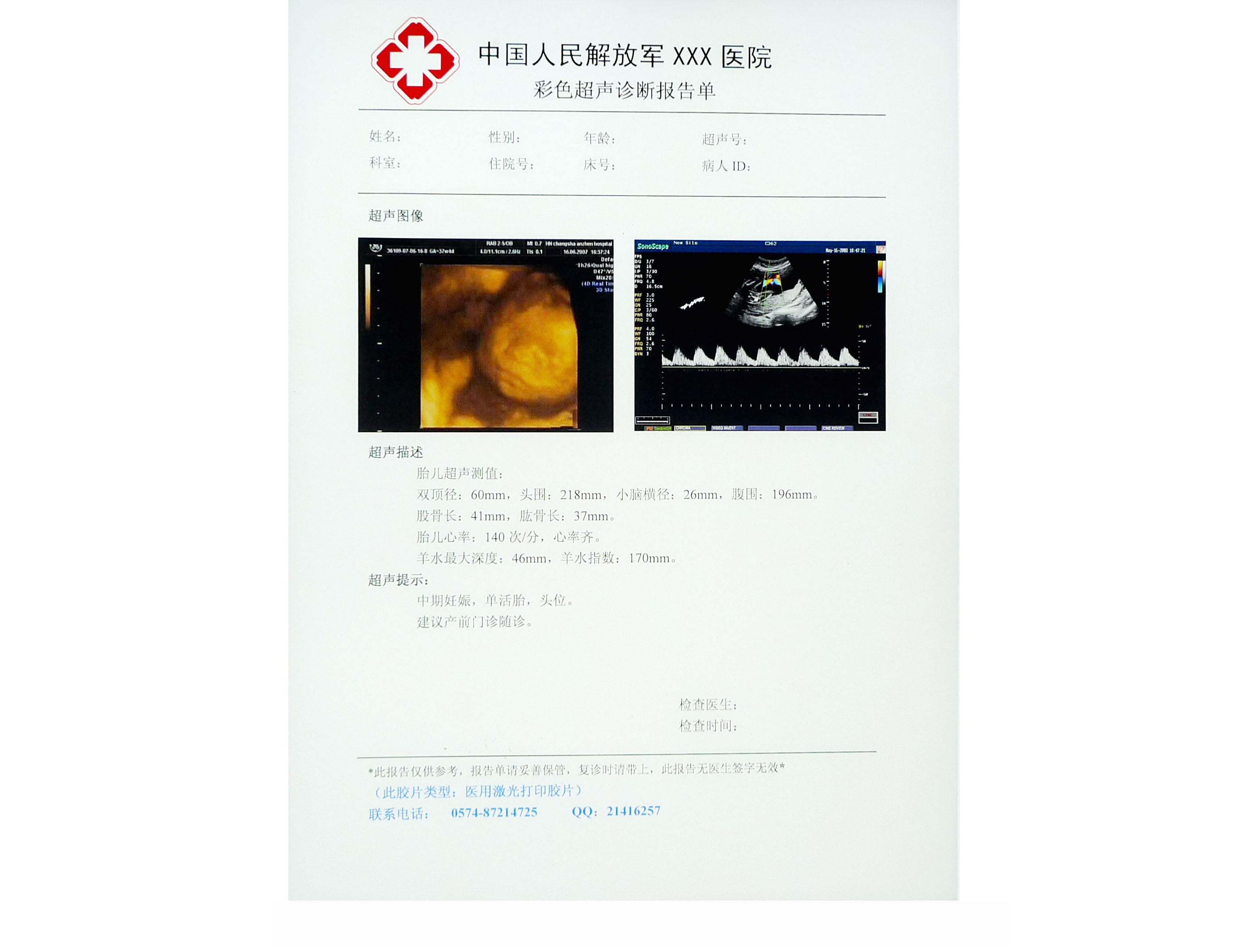 Scratch-resistant X-ray Paper Medical Film For KND-DRYTEC-3000, KND ...